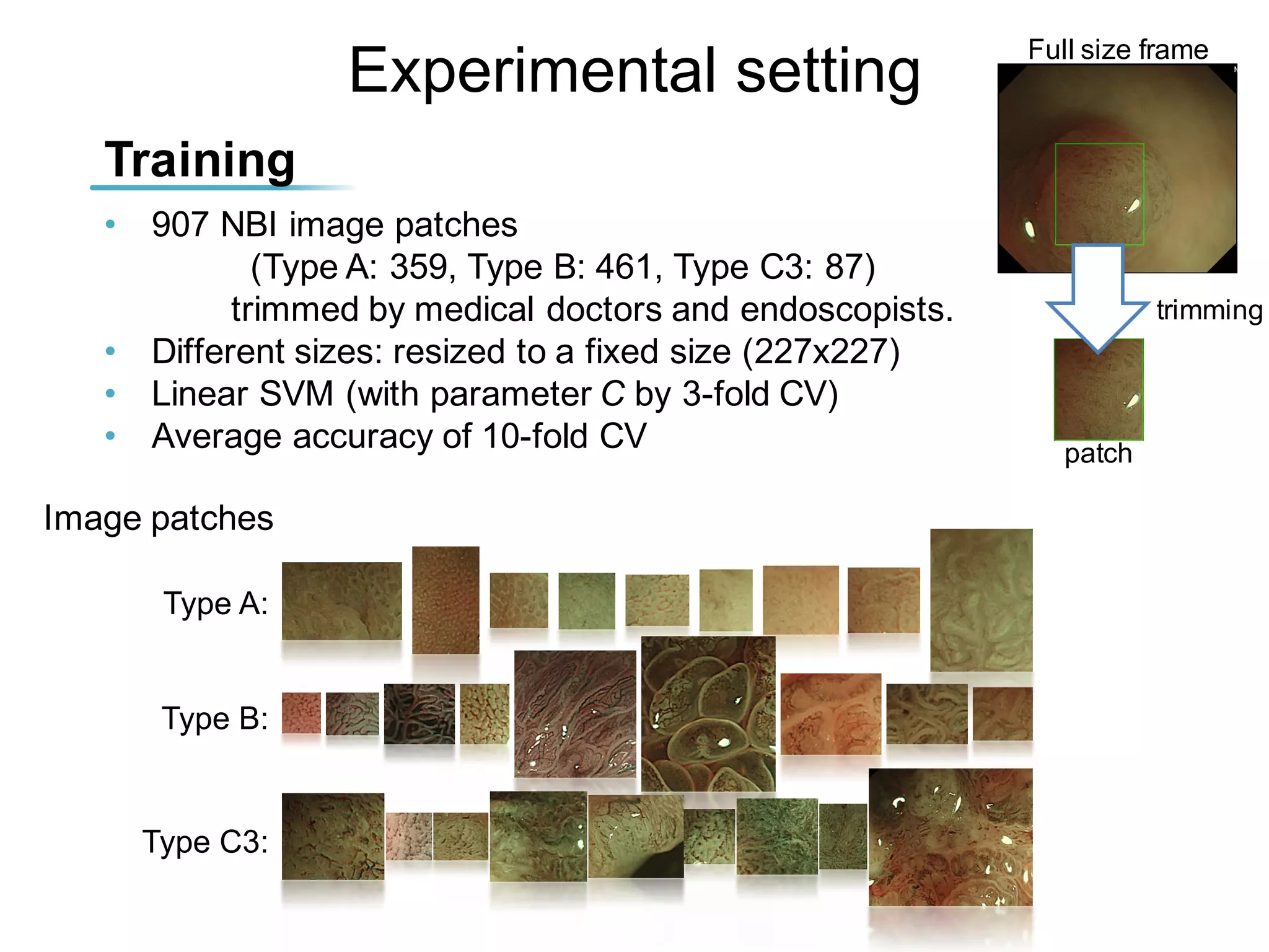 Computer-Aided Colorectal Tumor Classification in NBI Endoscopy Using ...