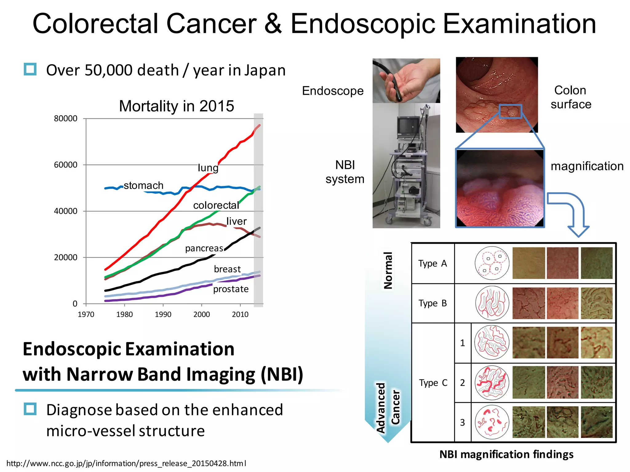 Computer-Aided Colorectal Tumor Classification in NBI Endoscopy Using ...