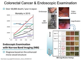 Computer-Aided Colorectal Tumor Classification in NBI Endoscopy Using ...