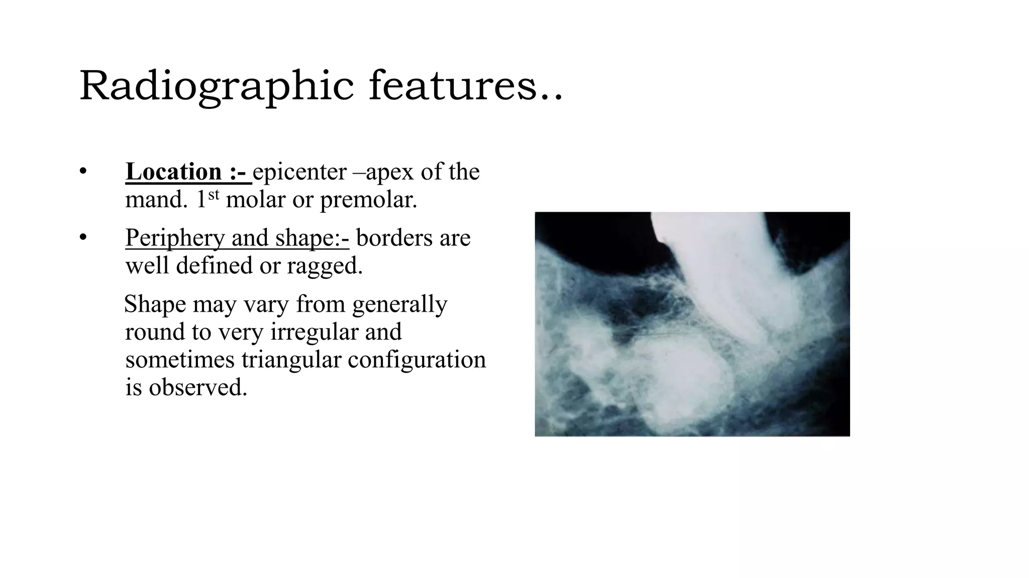 periapical radiopacities | PPTX