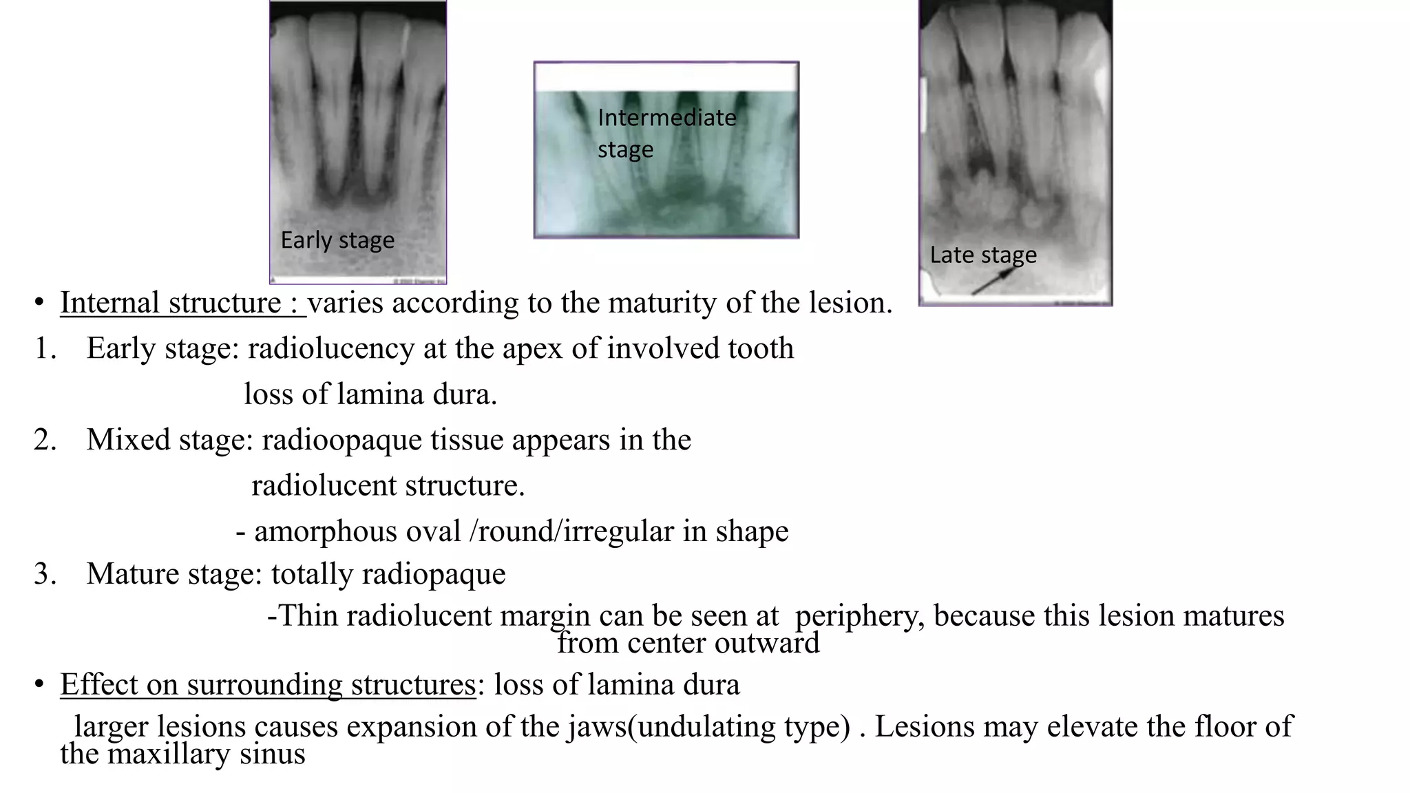 periapical radiopacities | PPTX