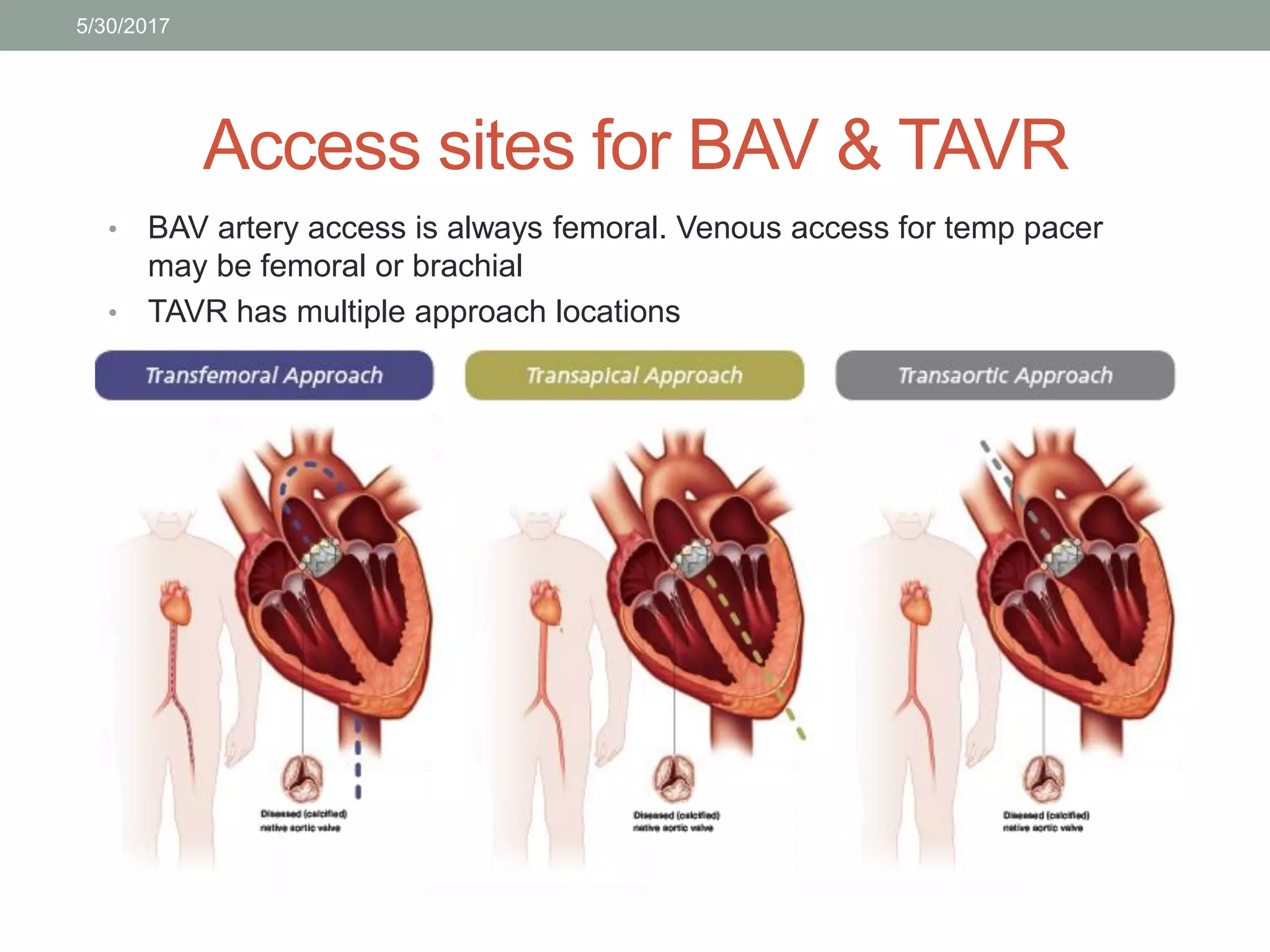 Care of the cardiac procedure patient | PDF