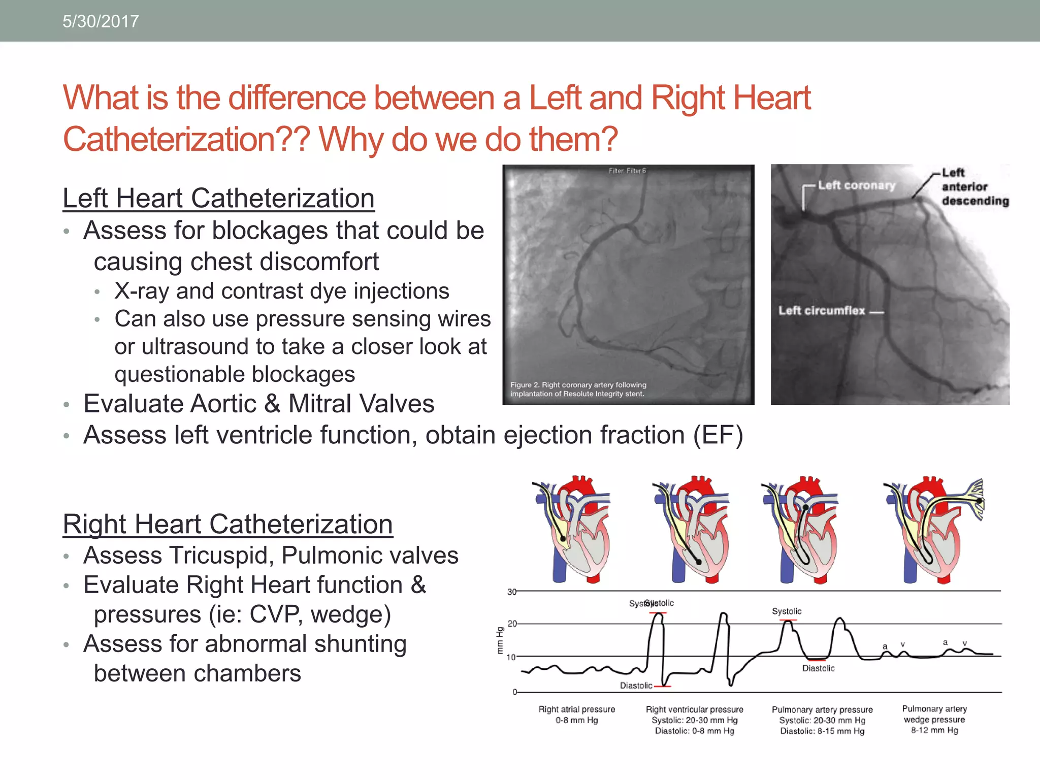 Care of the cardiac procedure patient | PDF