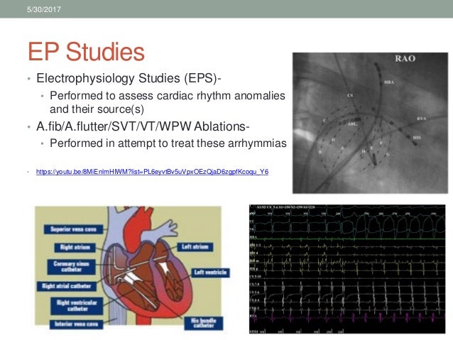 Care of the cardiac procedure patient