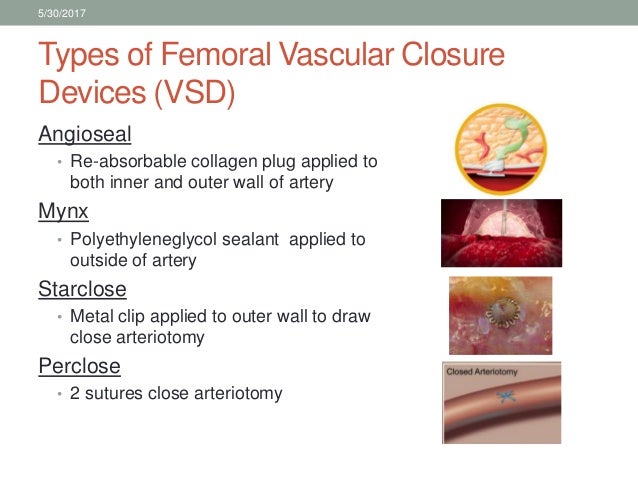 Care of the cardiac procedure patient