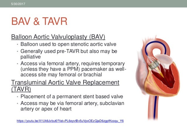 Care of the cardiac procedure patient