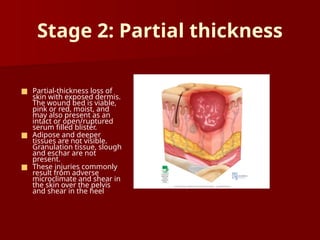 Classification of Wounds for first aid course | PPTX