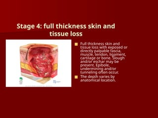 Classification of Wounds for first aid course | PPTX