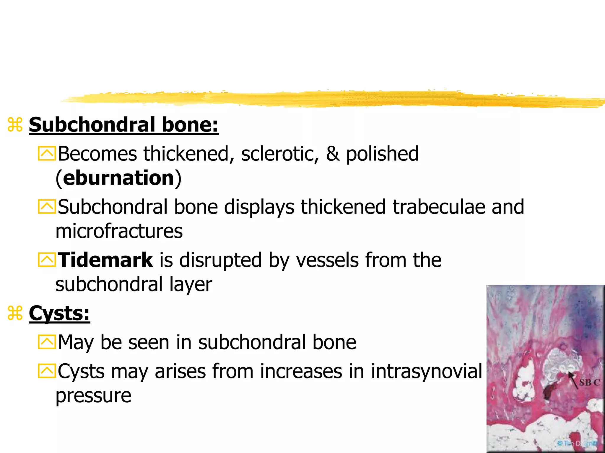 Osteoarthritis lecture for UG | PPTX