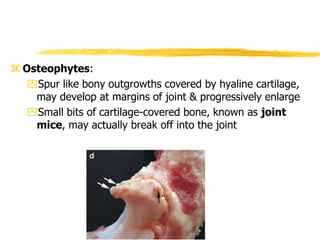 Osteoarthritis lecture for UG | PPTX