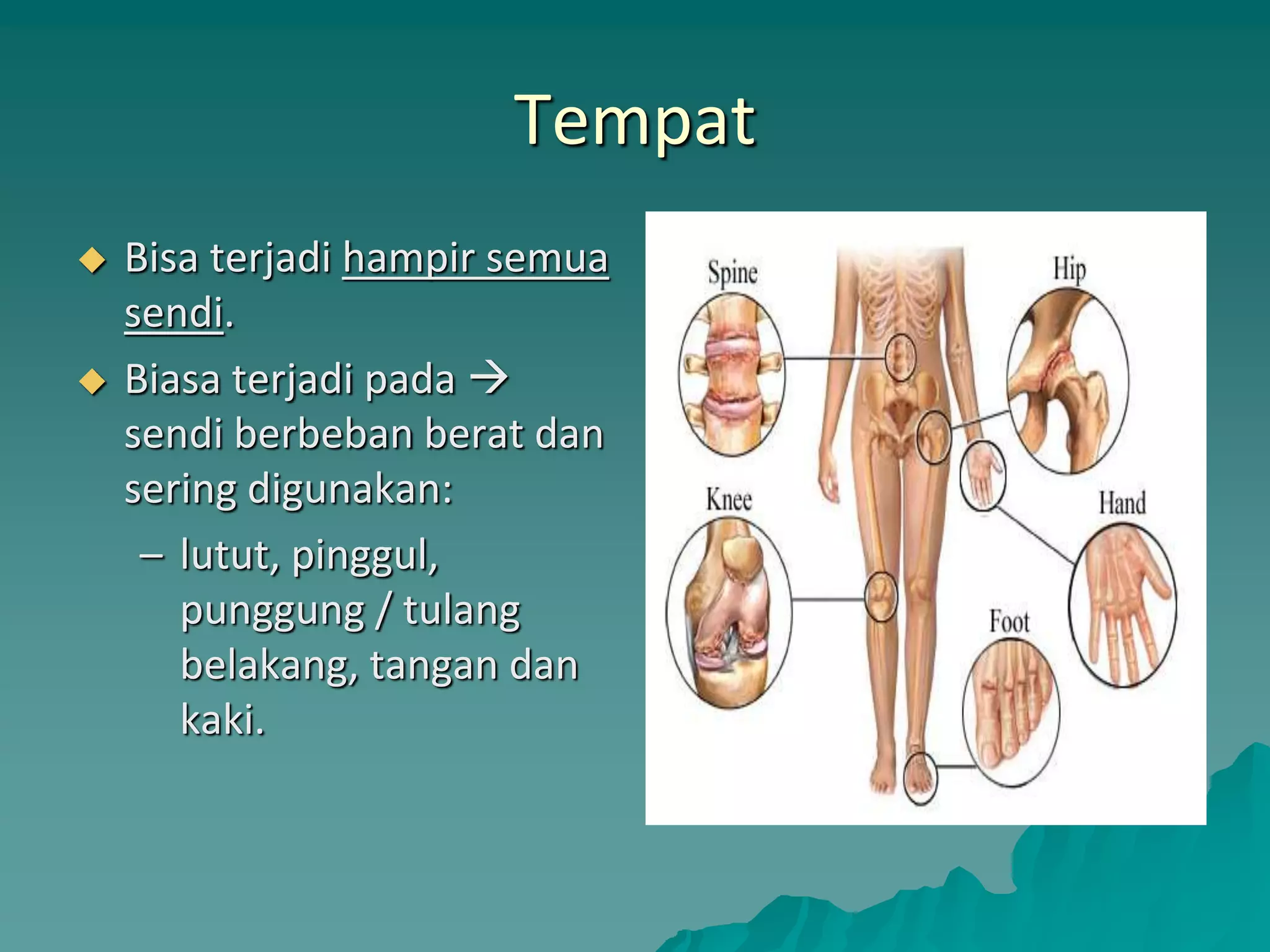 OA.ppt | Free download