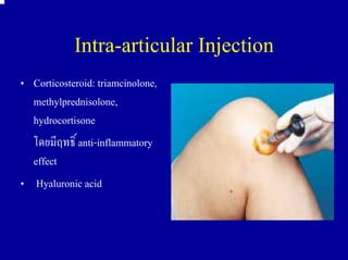 Medical Management in OsteoarthritisOsteoarthritis | PPT