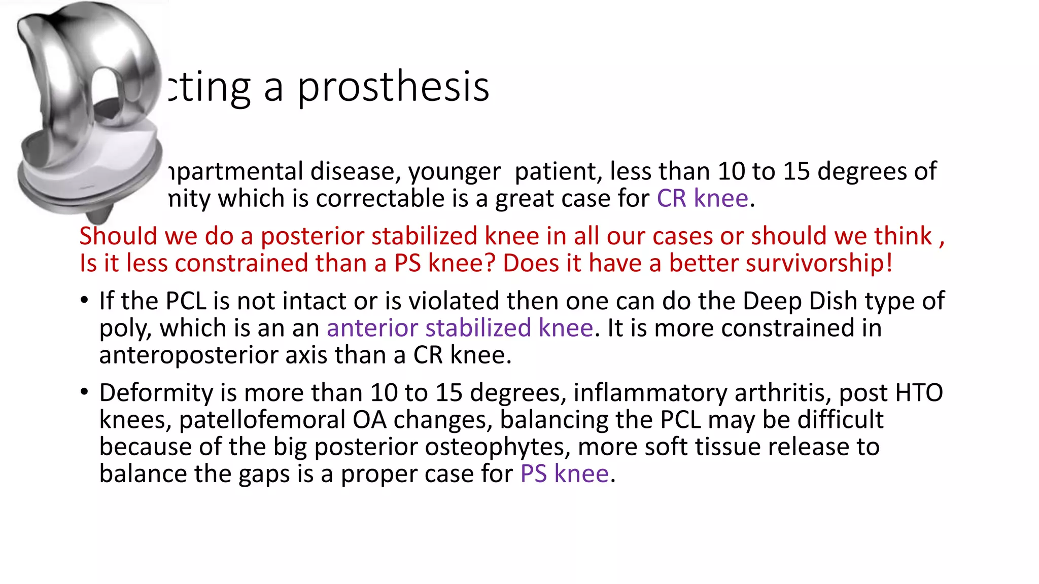 practical tips in planning TKR | PPTX