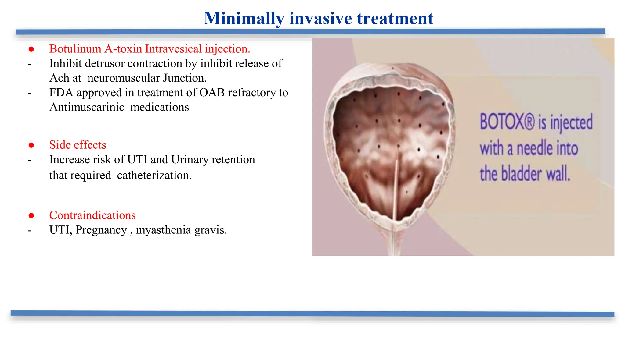 OVERACTIVE BLADDER AND THEIR MANAGEMENT. | PPTX