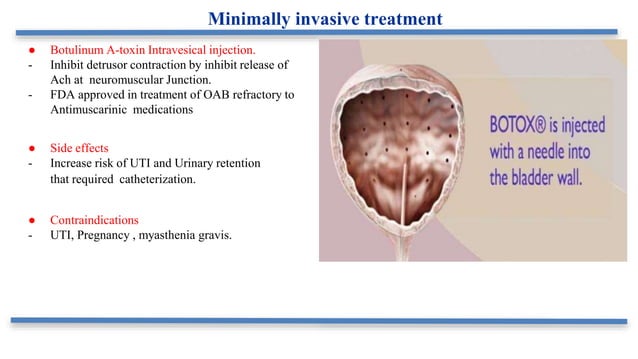 OVERACTIVE BLADDER AND THEIR MANAGEMENT. | PPTX | Digestive Disorders ...