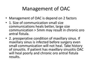 Oroantral fistula | PPTX