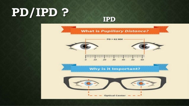O.A. 2ND & 3RED YEAR CLASS REGARDING BASIC ABOUT IPD class