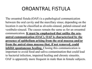 Oroantral Communication and Oroantral Fistula | PPTX