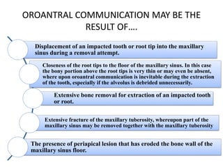 Oroantral Communication and Oroantral Fistula | PPTX