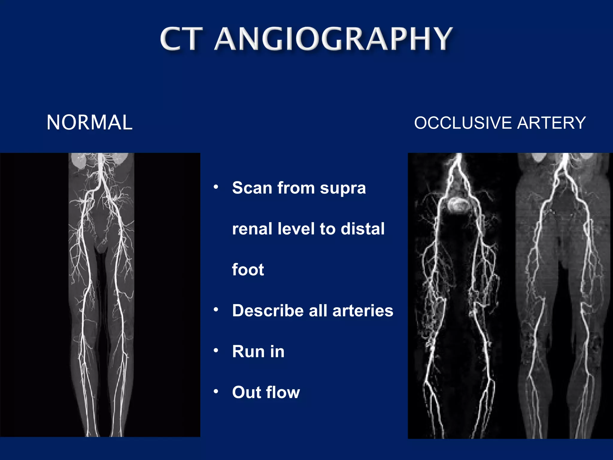 occlusive arterial disease | PPT