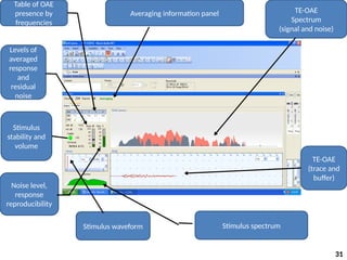 OAE in Pediatric Population a good ppt for audiology students | PPTX
