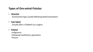 Oro-antral fistula | PPTX