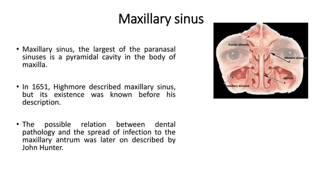 Oro-antral fistula | PPTX | Ear, Nose and Throat Conditions | Diseases ...