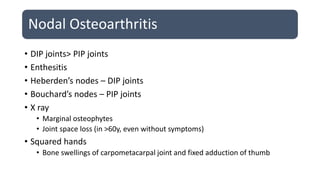 Osteoarthritis | PPTX