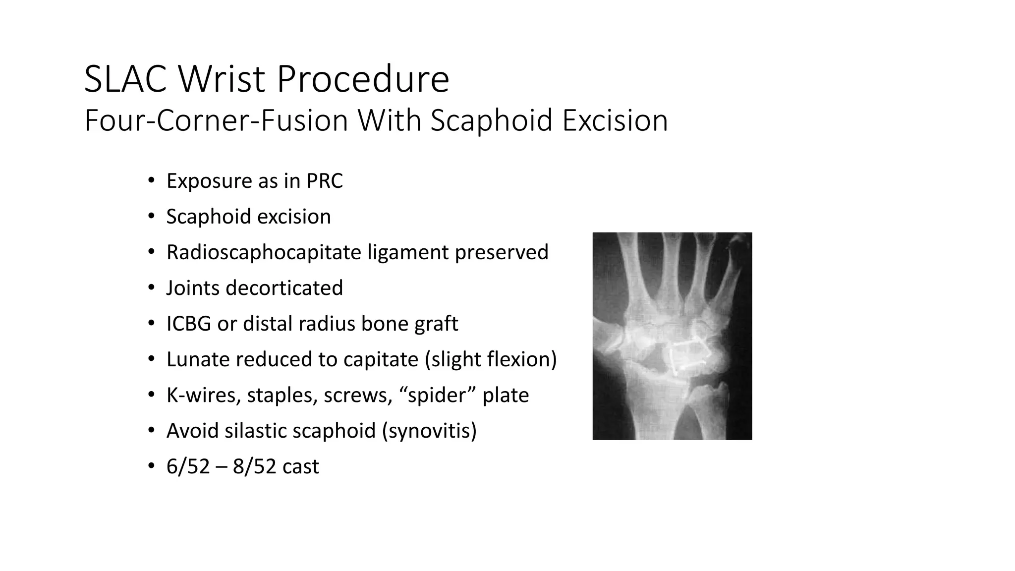 Osteoarthritis of the hand | PPTX