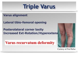Osteoarthritis in the young | PPT