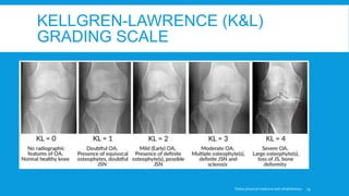 Osteoarthritis knee- introduction and approach | PPTX