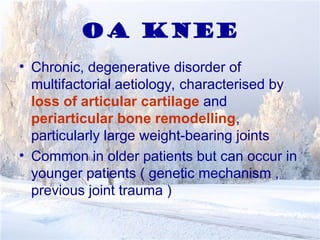 Osteoarthritis of the knee joint and its treatment | PPT