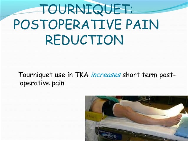 Clinical Evidence in the Surgical Treatment of Advanced Osteoarthritis ...