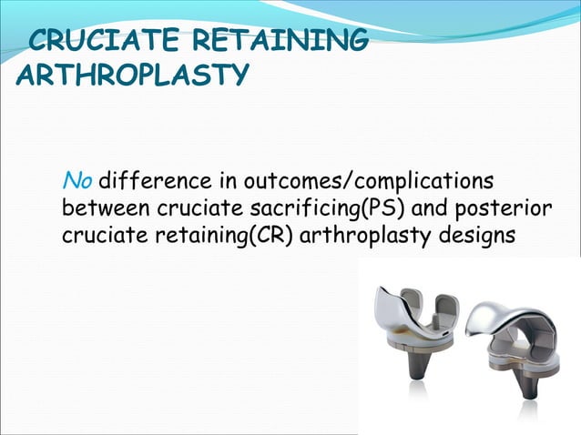 Clinical Evidence in the Surgical Treatment of Advanced Osteoarthritis ...