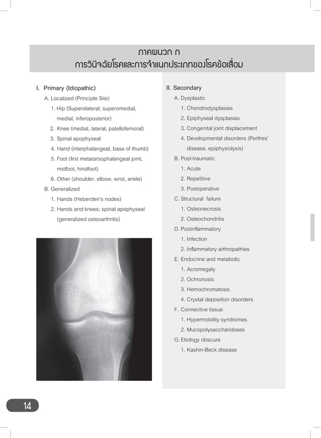 การรักษาโรคข้อเข่าเสื่อม Oa kneeguideline | PDF