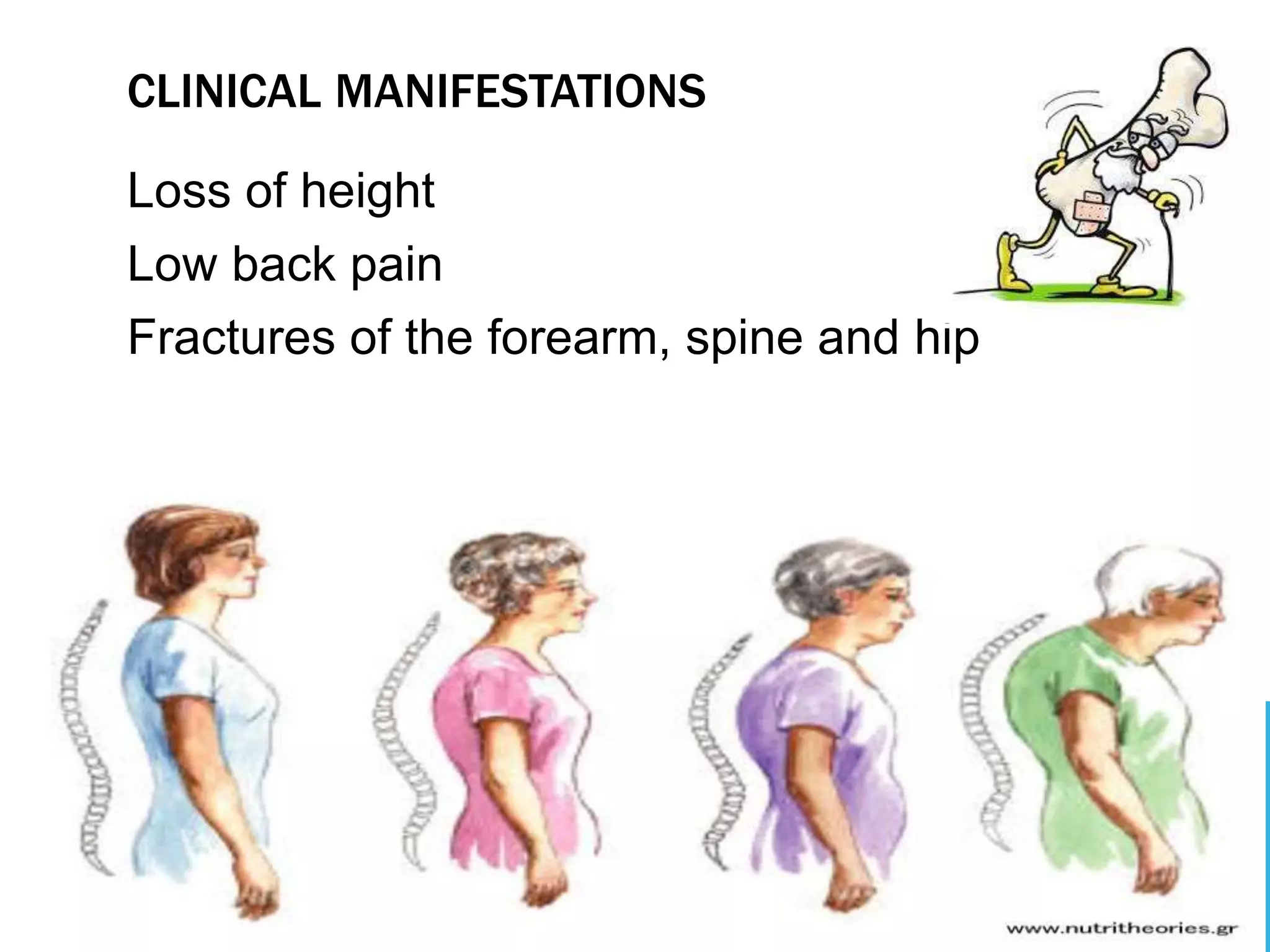 OA Mobility Fracture for Ethel.pptx