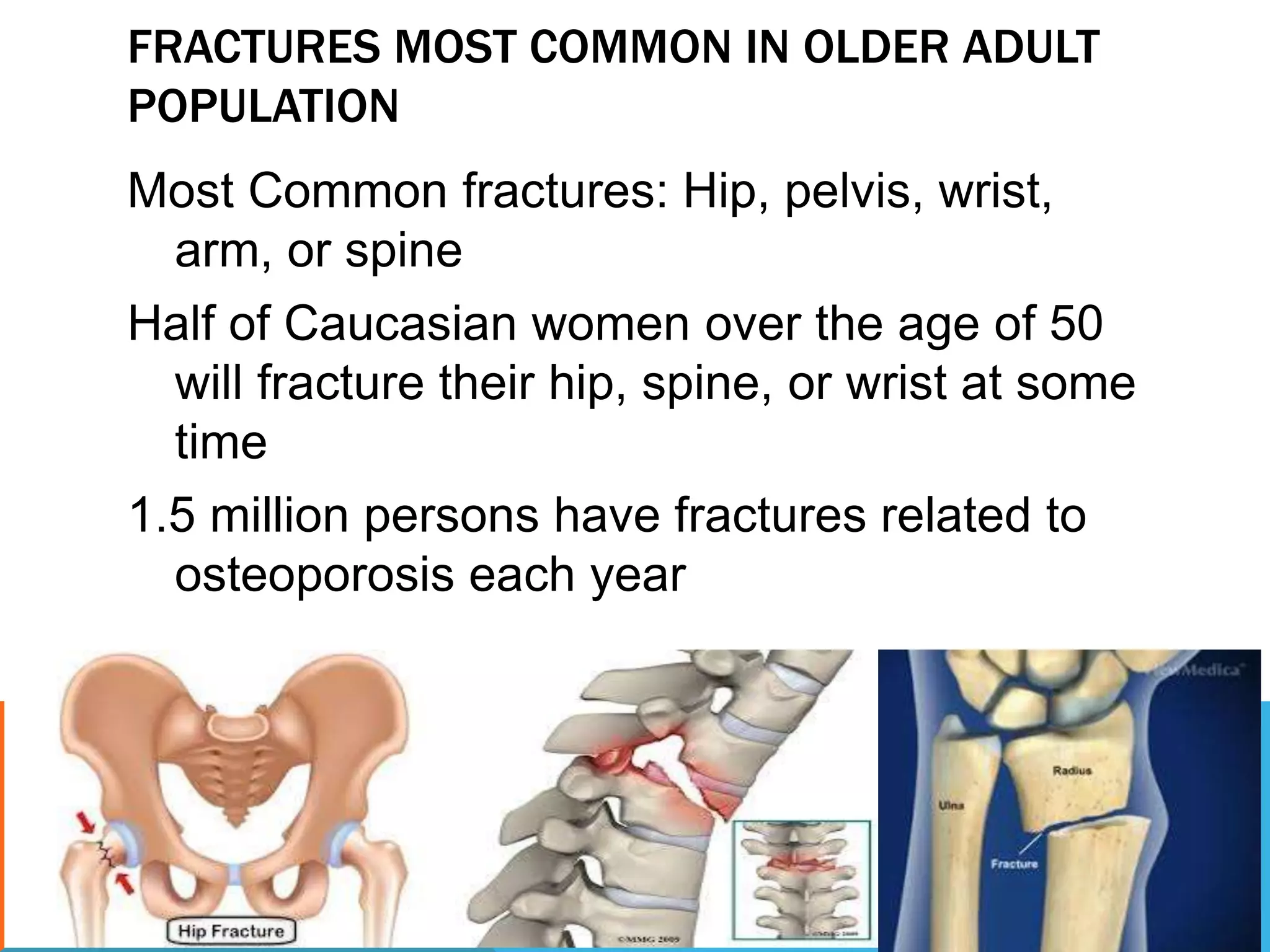 OA Mobility Fracture for Ethel.pptx