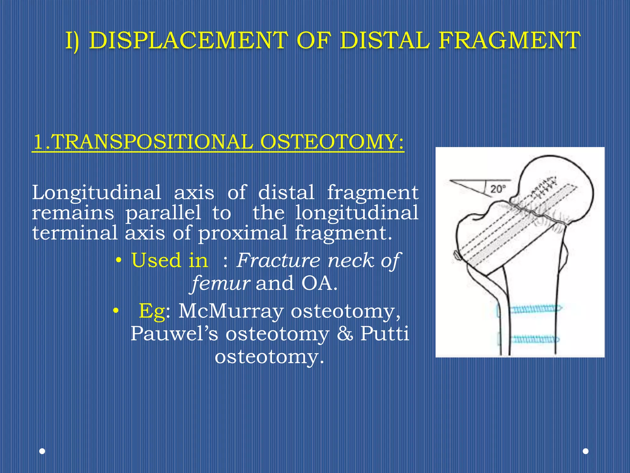 Osteotomies around hip by dr rohit kumar | PPTX