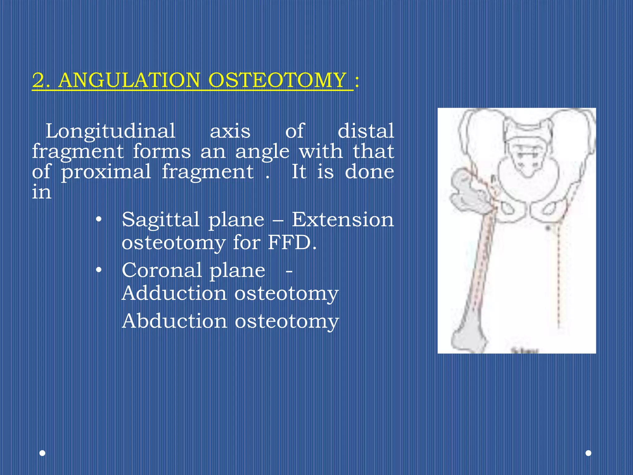 Osteotomies around hip by dr rohit kumar | PPTX