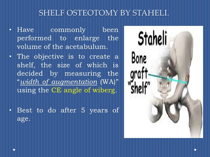 Osteotomies around hip by dr rohit kumar Osteotomies around hip by dr rohit kumar