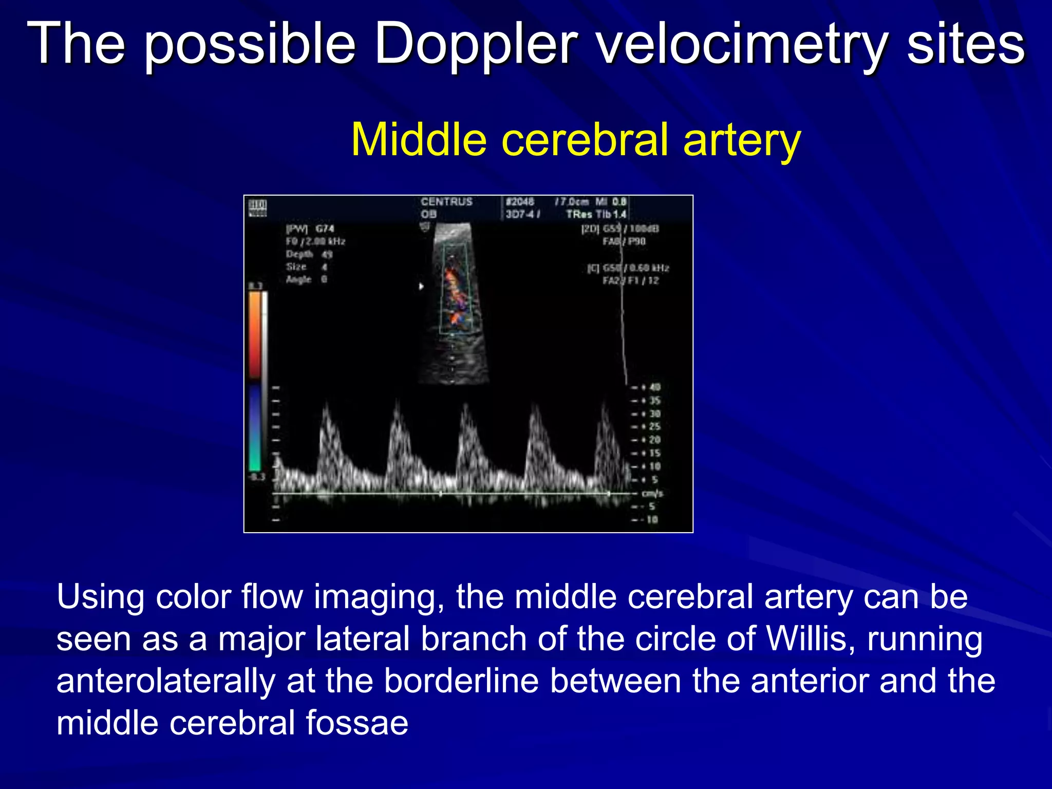 Obstetrics doppler ultrasound | PPT