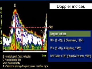 Obstetrics doppler ultrasound | PPT