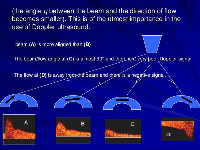 Obstetrics doppler ultrasound