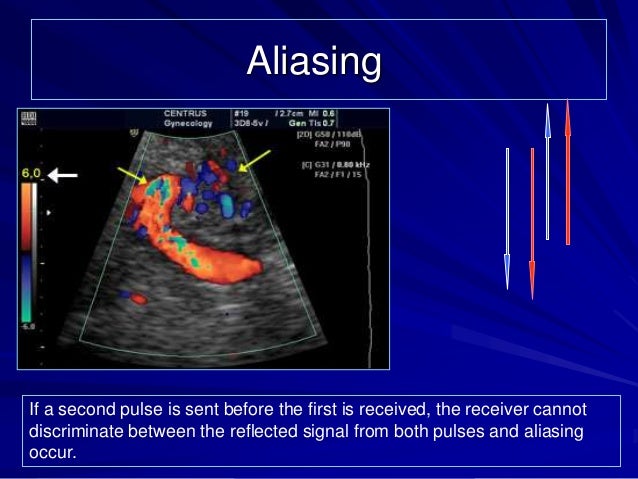Obstetrics doppler ultrasound