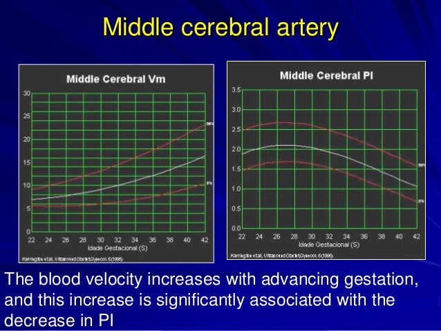 Obstetrics doppler ultrasound