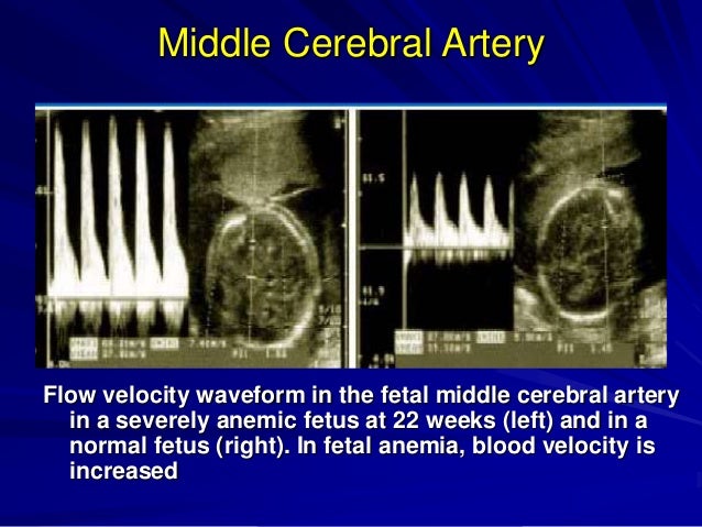 Obstetrics doppler ultrasound