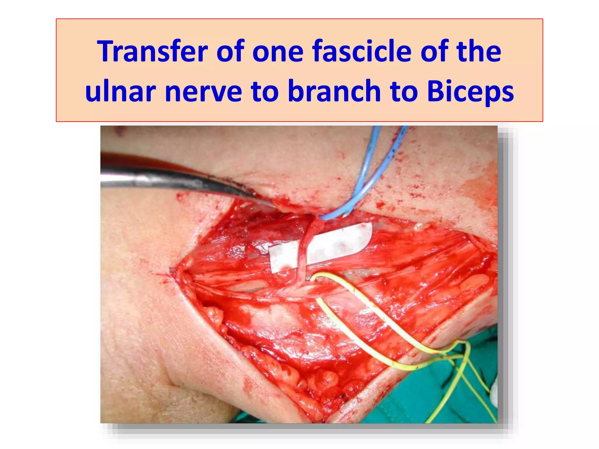 Oberlin Transfer | PPTX