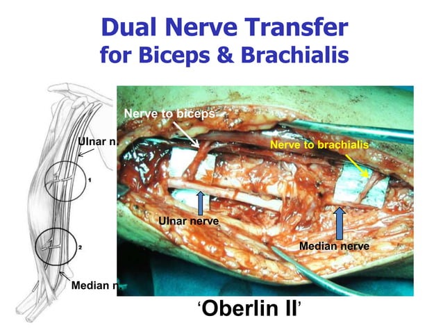 Oberlin Transfer | PPTX