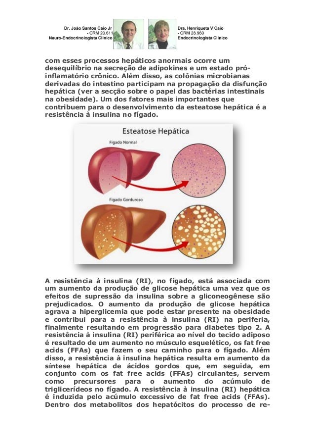 OBESIDADE E A DOENÇA HEPÁTICA GORDUROSA NÃO ALCOÓLICA (DHGNA) ESTEATO…