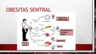 obesitas2.pptx